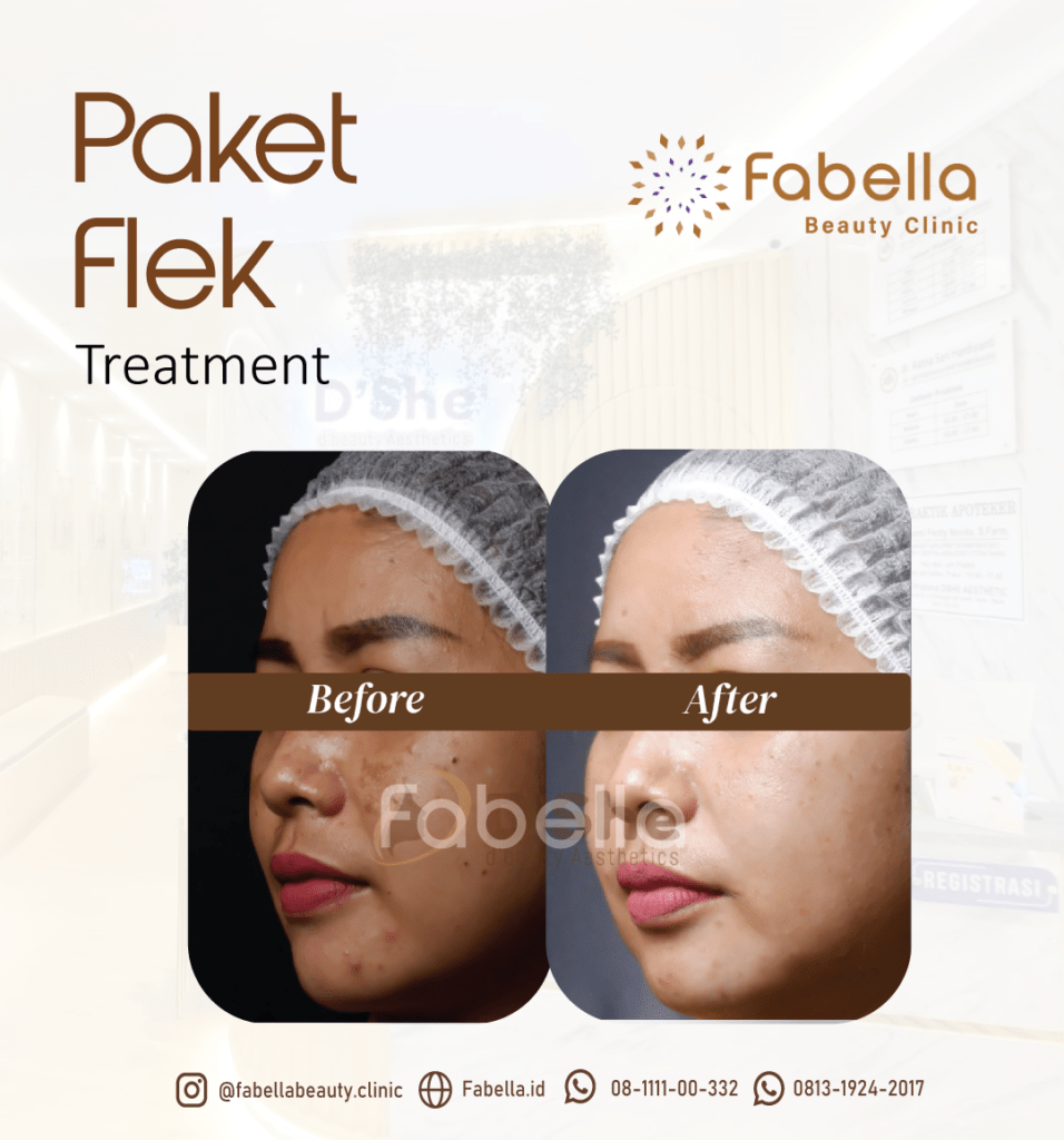 Testimoni Pasien Fabella Beauty Clinic - Klinik Kecantikan Terbaik Depok